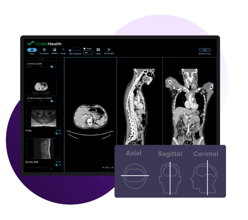 CrelioHealth PACS Reviews & Pricing 2025